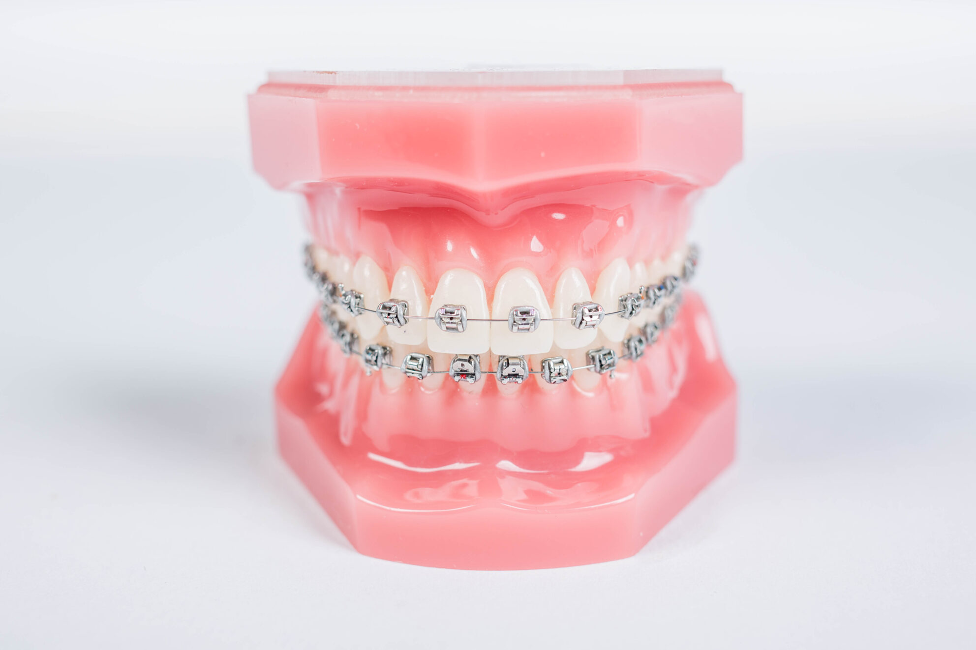 Beugel tandarts bij jou in de buurt - Orthodontie - Dental Clinics