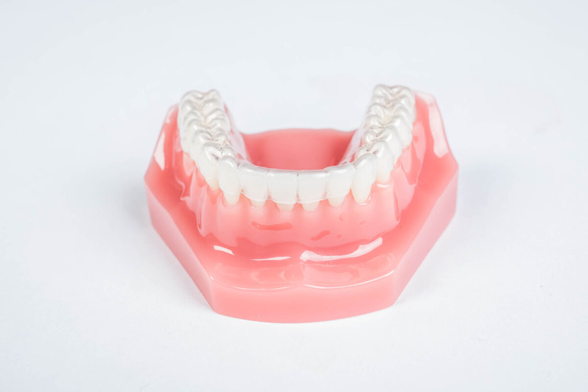 Beugel tandarts bij jou in de buurt - Orthodontie - Dental Clinics
