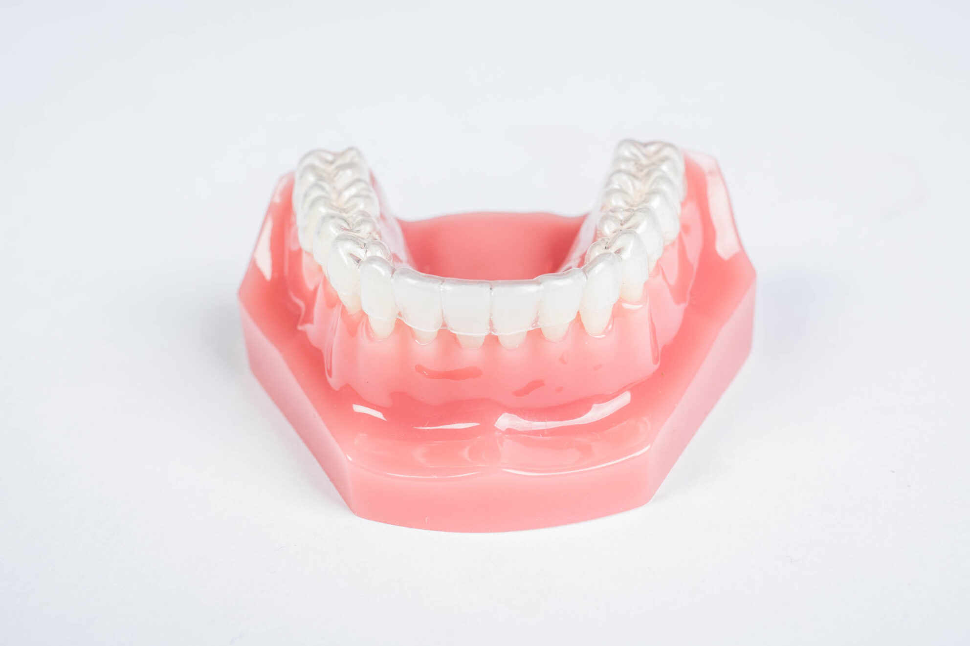 Beugel tandarts bij jou in de buurt - Orthodontie - Dental Clinics